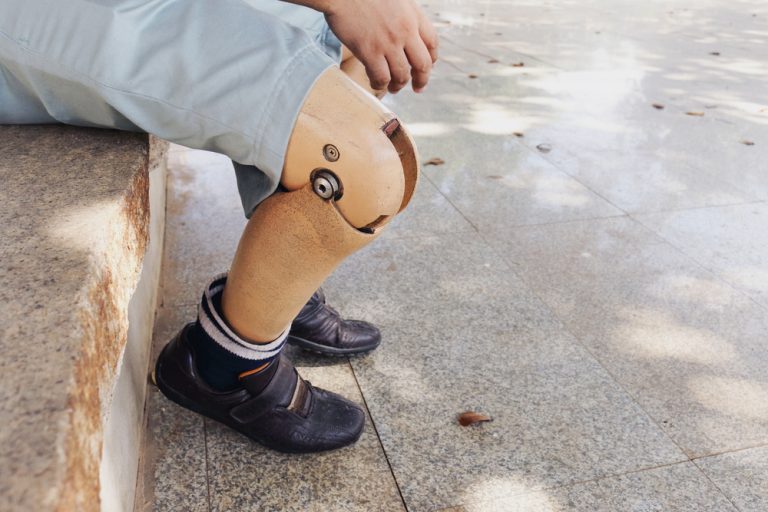 Injection Molding for Prosthetic Parts