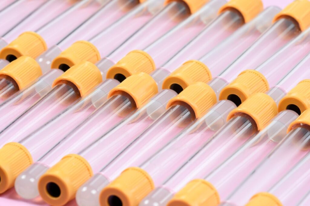 3 Things To Consider For Plastic Overmolding